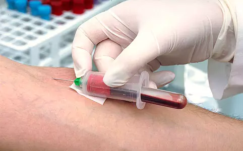 Cosa dicono gli esami del sangue