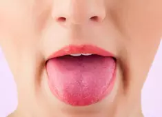 Vad händer om du bränner tungan?