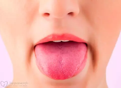 Hvad hvis du brænder tungen?