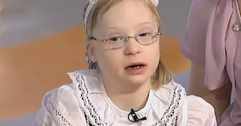 Andere kinderen: Downsyndroom