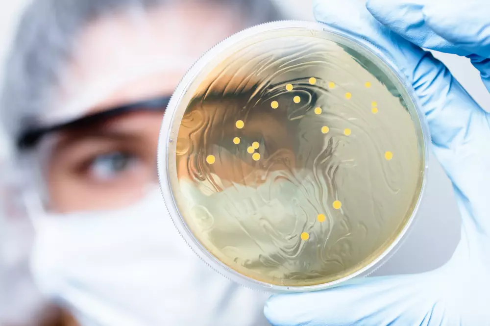 Ị kwesịrị ịtụ egwu nje bacteria?