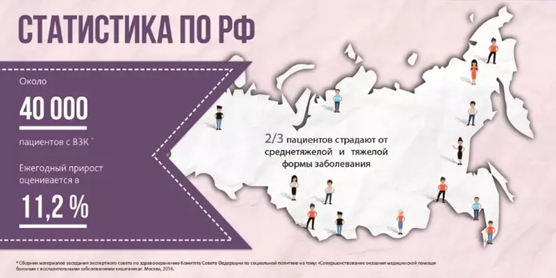 Oroszországban évente 11% -kal több beteg van gyulladásos bélbetegségben 11398_2