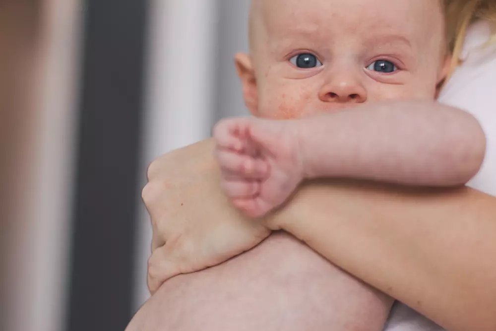 "Pesta campak": mengapa ibu bapa menjangkiti anak-anak mereka