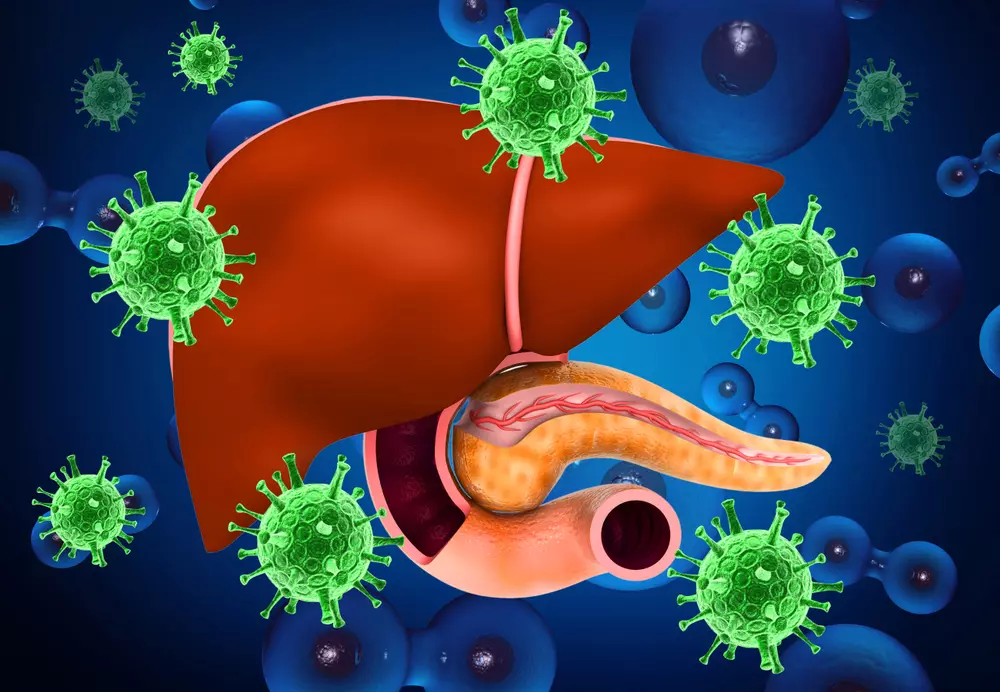 Hepatitis B: hoe weet ik of ik ziek ben als het asymptomatisch overgaat?