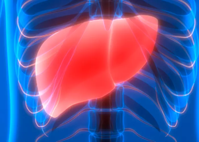 Prevalencia de la enfermedad del hígado graso no alcohólico en pacientes con enfermedad de las arterias coronarias 12446_3