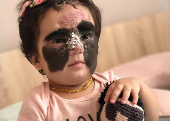 La mère de la fille au "masque de Batman" a parlé de la prochaine opération