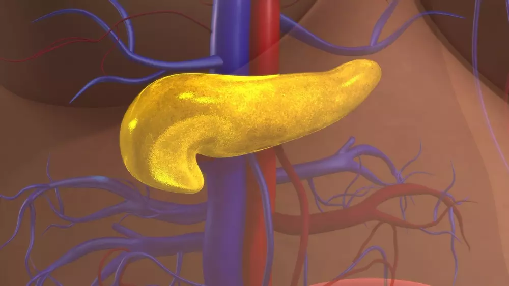 ໂຣກ Pancreatitis: ວິທີປິ່ນປົວມັນ, ແລະເຫຼົ້າມາຈາກໃສ? 12983_2