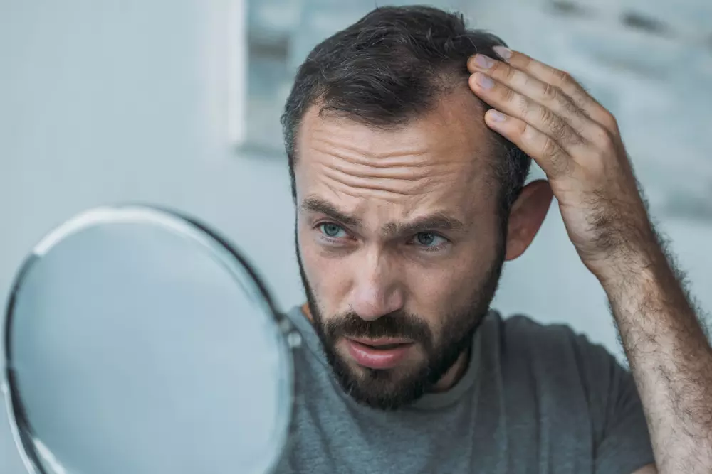 Čas je, da se primete za glavo: kako ustaviti izpadanje las? 2012_2