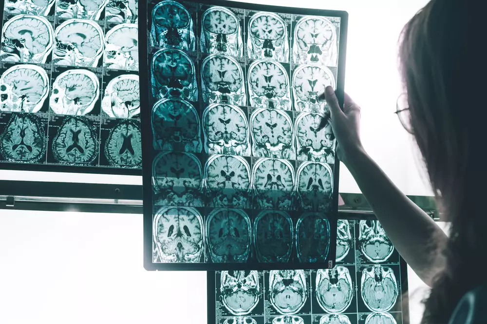 Alzheimerova choroba: čo filmy hovoria o ťažkej diagnóze 2539_2
