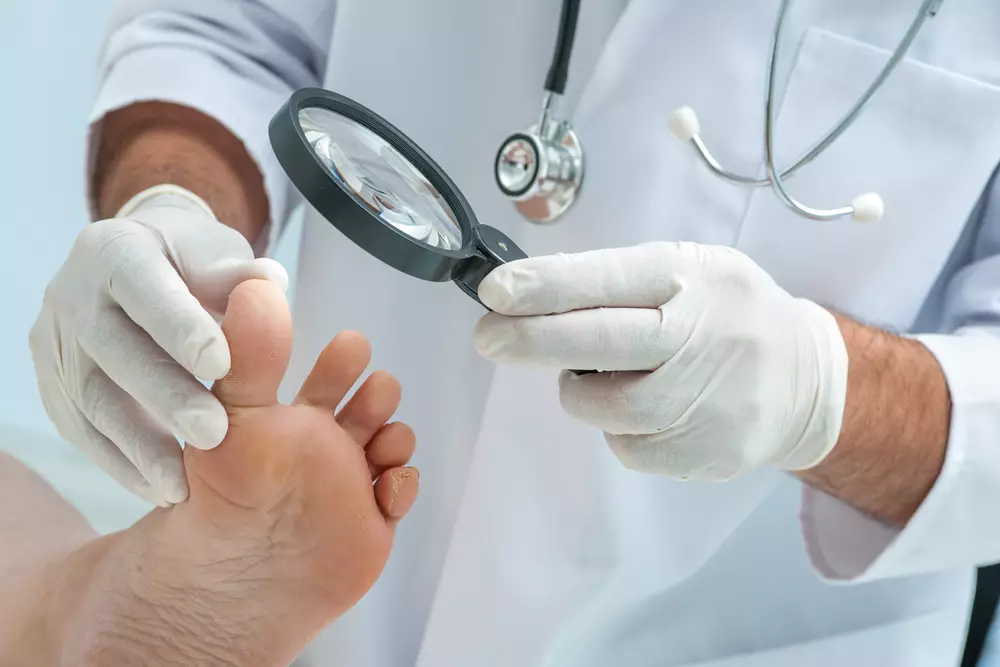 Gout: Symptomer, Diagnos, a Behandlung 2916_3