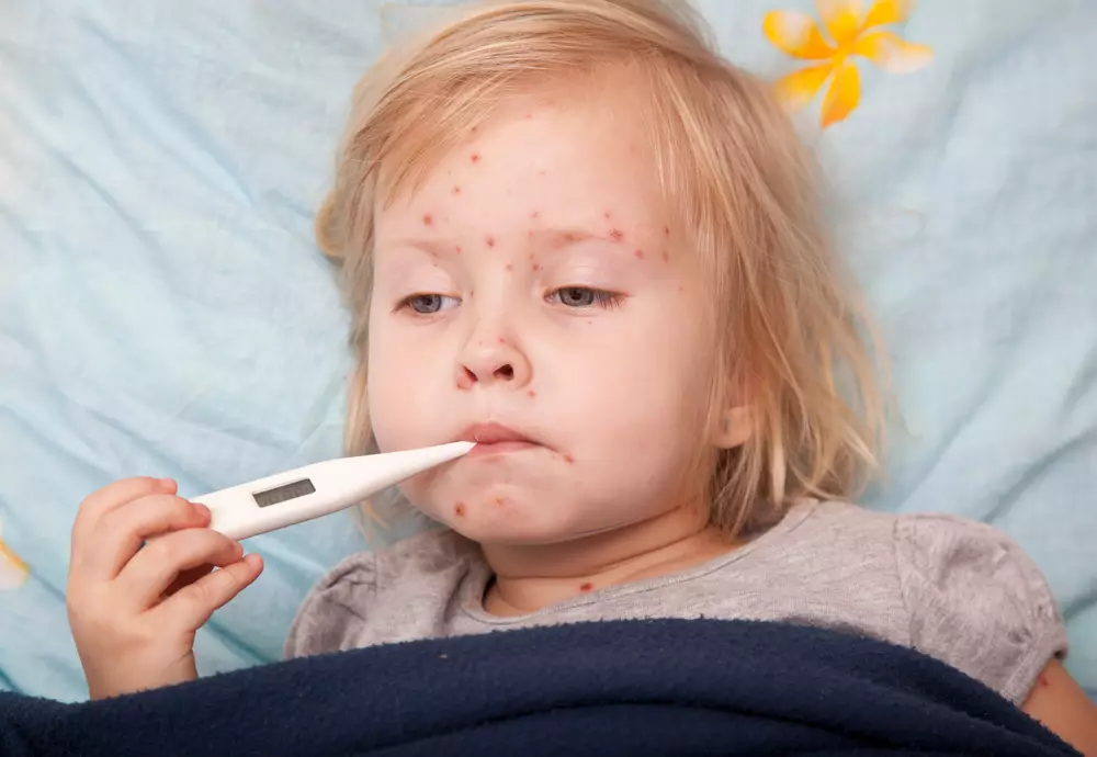 שלושה חיסונים לפני החגים: אילו חיסונים צריך לתת לילדים 2954_2
