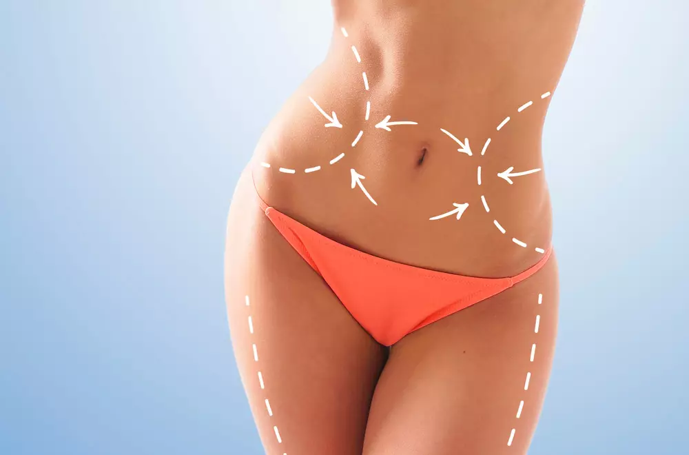 Handap ku gajih sareng stereotip: 5 mitos ngeunaan liposuction
