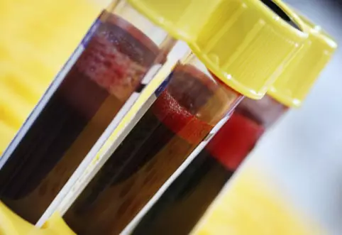Laboratoriskā asins analīze 4120_1
