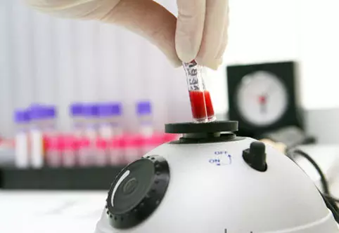 Test de sânge în laborator 4120_2