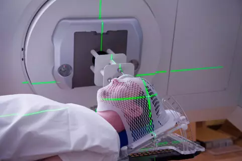 Gamma Knife: The Invisible Scalpel Against Brain Cancer 4144_1