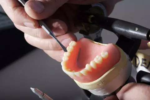 ретенірованние зуб