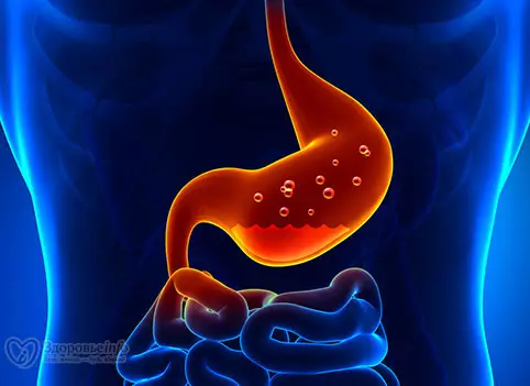 Chronic gastritis: Mehato e 3 ea ho fola