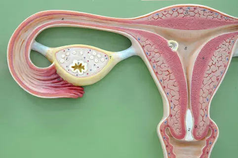 Paano gamutin ang mga may isang ina fibroids