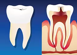 ஈறுகள் - ஆரோக்கியத்தின் கண்ணாடி 4990_4