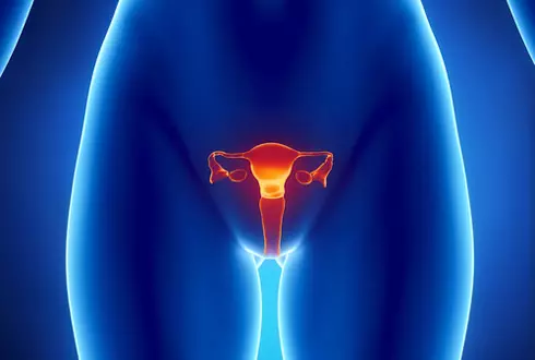 Umdlavuza we-Endometrial