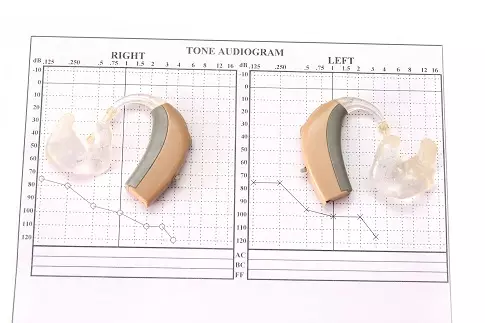 Audiometria - një udhëzues për metodat diagnostikuese