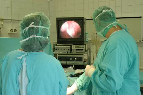 Laparoscopy - umurongo ngenderwaho muburyo bwo gusuzuma