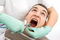 Dento-eltiro: la severa vero de la vivo