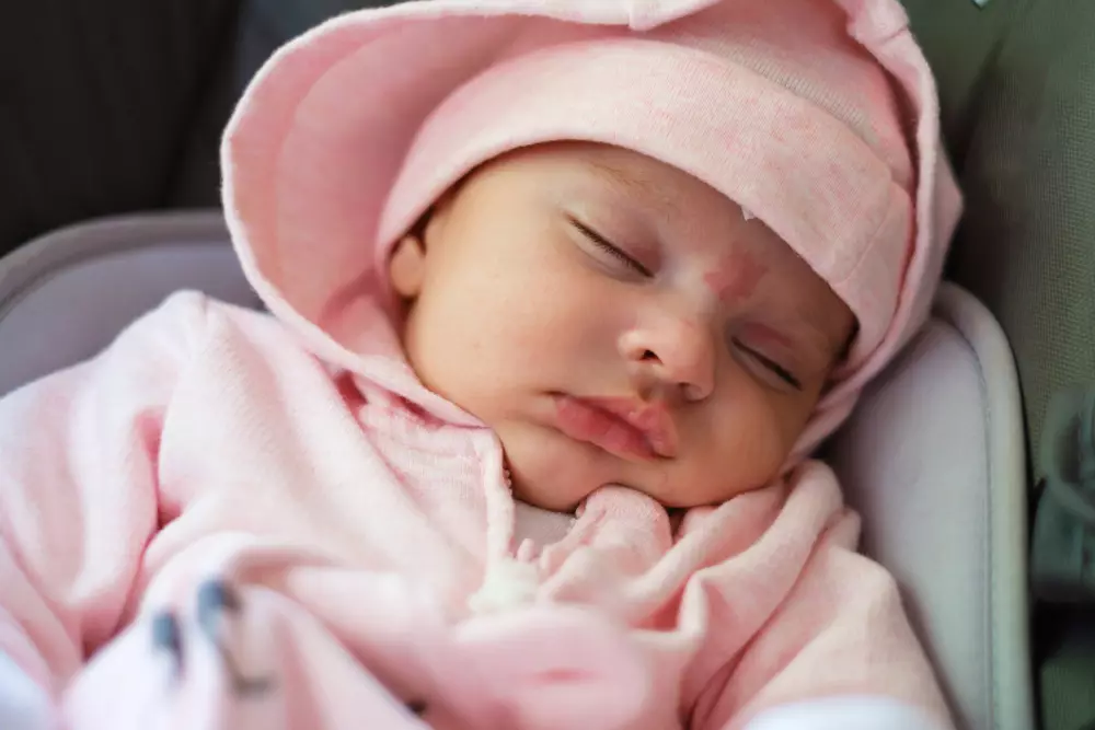 Pielea nou-născutului: sfaturi de îngrijire de bază 86611_2