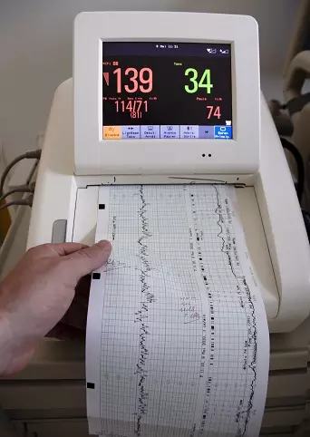 Pag-monitor sa fetal (cardiotocography) - usa ka panudlo sa pamaagi sa pagdayagnos 88019_2