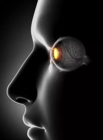تنظير العين - دليل لطرق التشخيص 88022_2