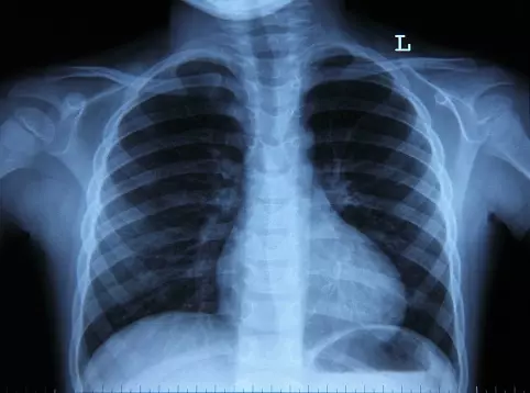 Radiografiýa - anyklaýyş usullary üçin gollanma 88132_2
