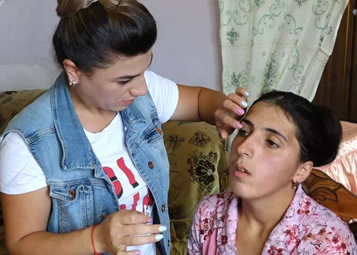 Menzogna di cristallo: l'opinione dei medici su una ragazza dell'Armenia che piange con i cristalli 9084_1