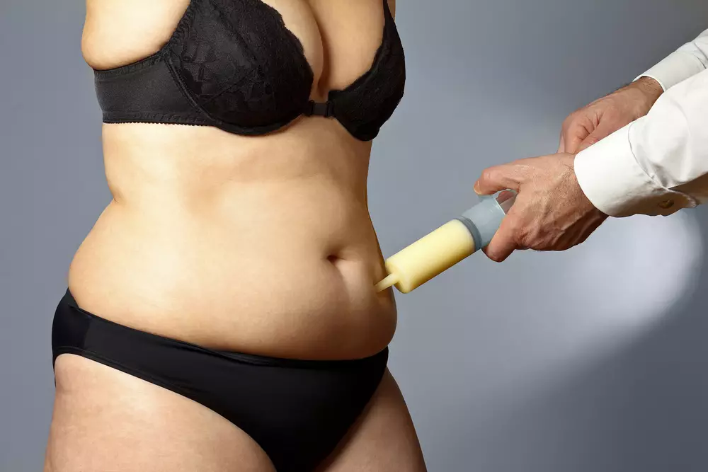 I-Goodbye Fat: Izinganekwane ze-Debunking Liposuction