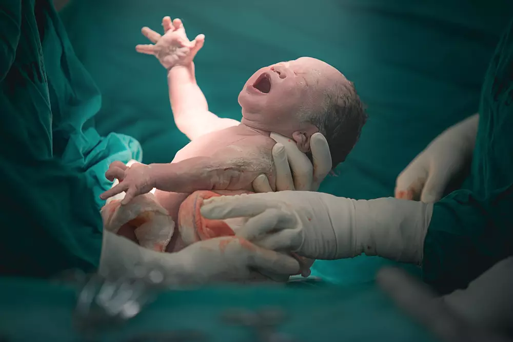 WHO against caesarean section: why are scientists urging women to give birth on their own? 9692_2